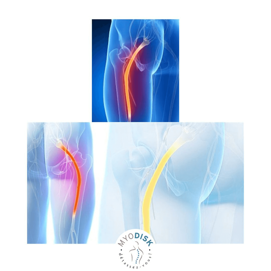 Maxime Obadia - Ostéopathe - Maxime Obadia